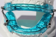 Oasys Herbst Appliance | Dream Systems Dental Sleep Lab